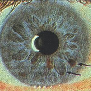Psicologia e Iridologia - uma união possível. A personalidade na íris ...