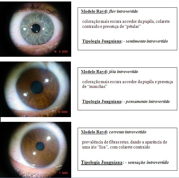 Psicologia e Iridologia - uma união possível. A personalidade na íris ...